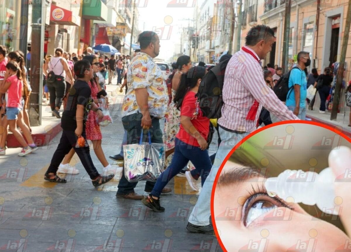 Yucatán Bajan Casos De Conjuntivitis En Lo Que Va Del Año